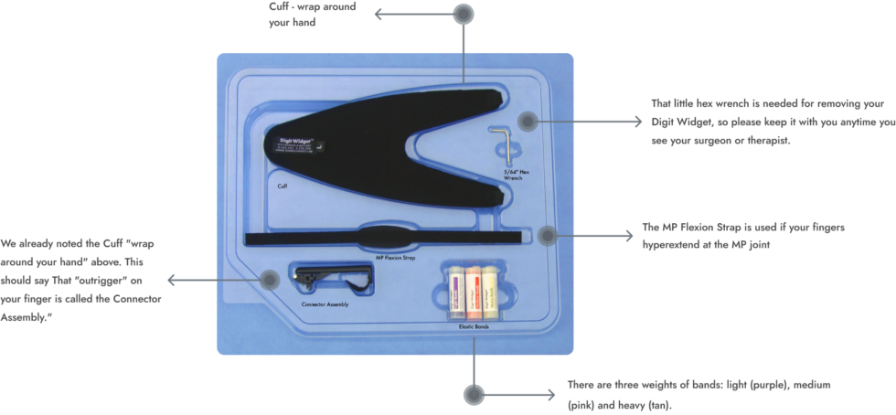 Digit Widget Surgery: A Key Step to Restoring Finger Mobility