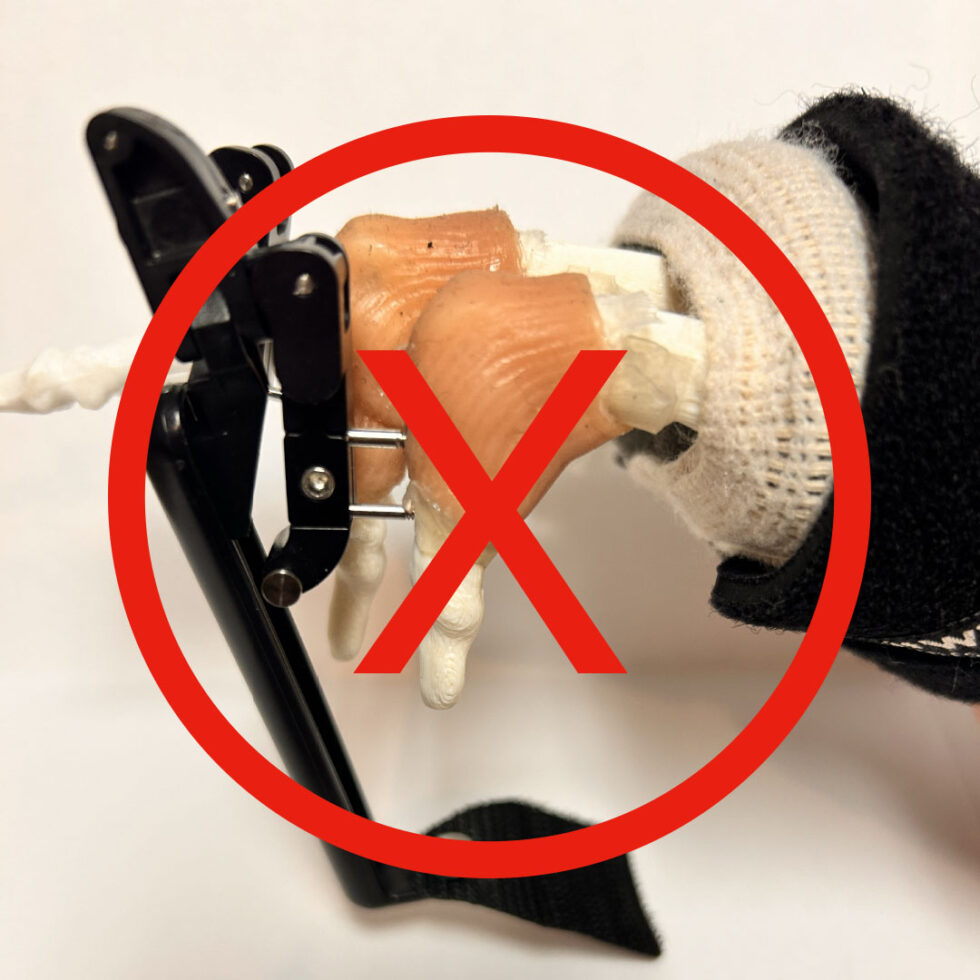 How to Wear and Care for Your Digit Widget: A Complete Guide